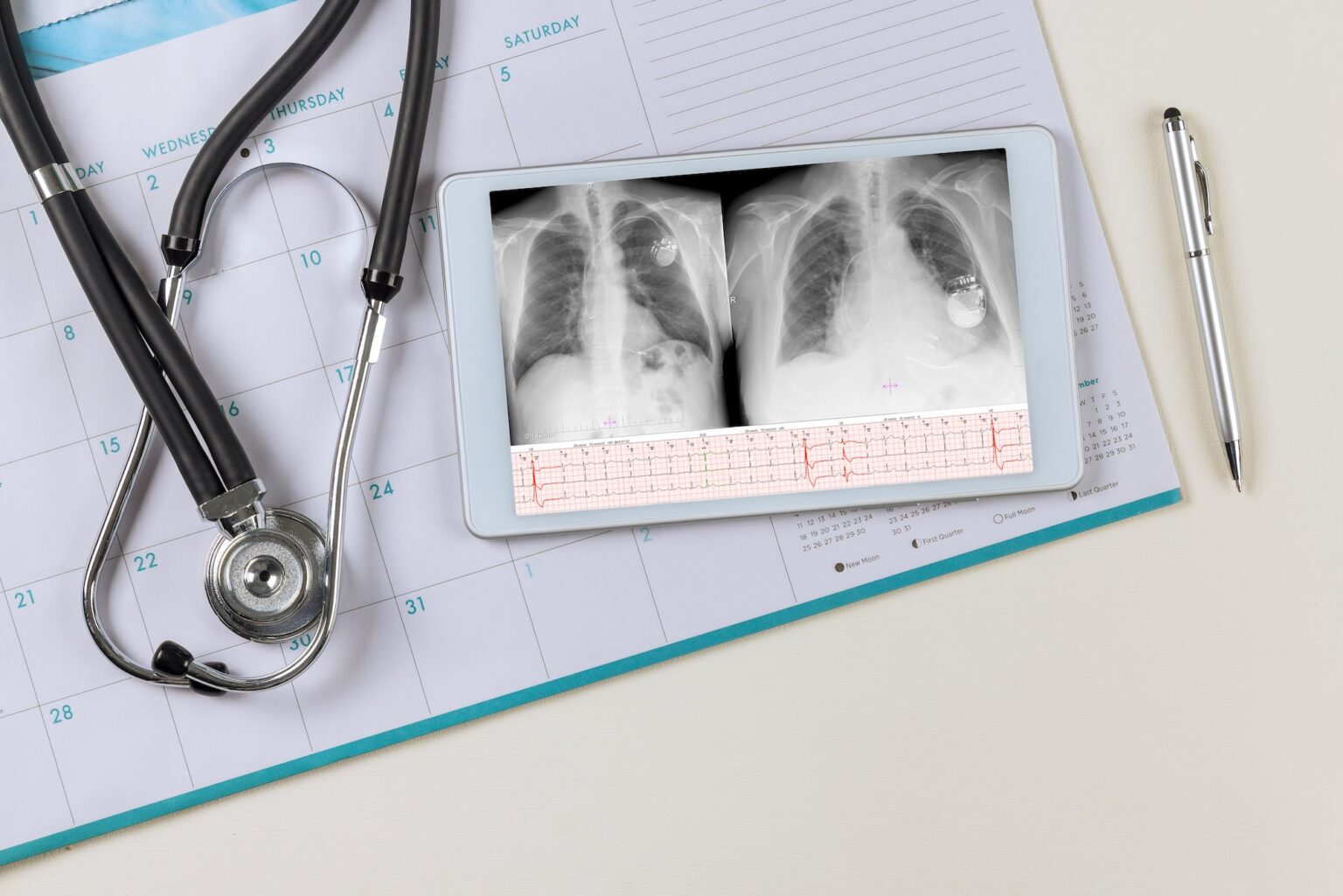 Colocación de Marcapasos, conceptos básicos. - Dr. Jorge González